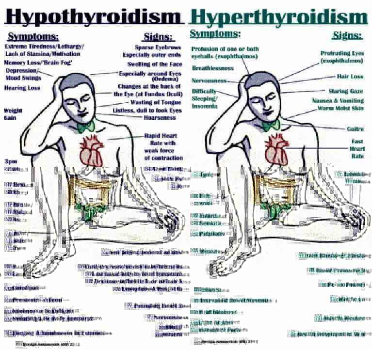All The Clues, Symptoms, Triggers And Therapy For Hypo And Hyperthyroidism