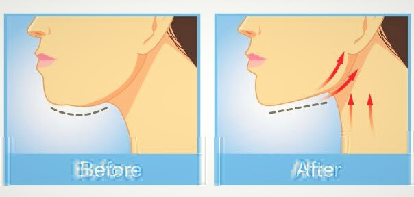 Good Riddance To Your Double Chin With These 3 Easy Exercises