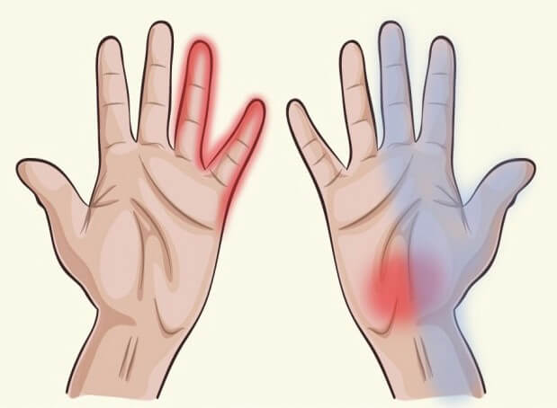 Signs On Your Hands Concerning Your Health